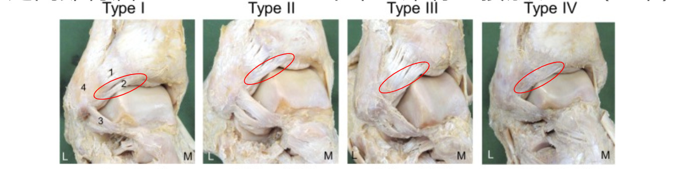 足関節外側 | アシエコ